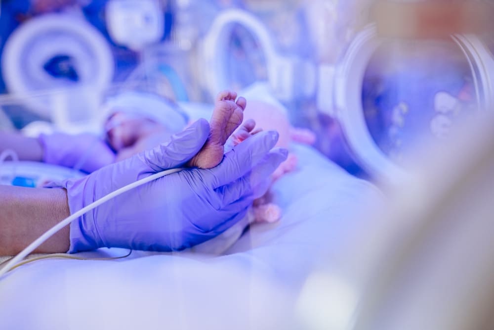 What Neonatal Resuscitation is? | Paulson Coletti