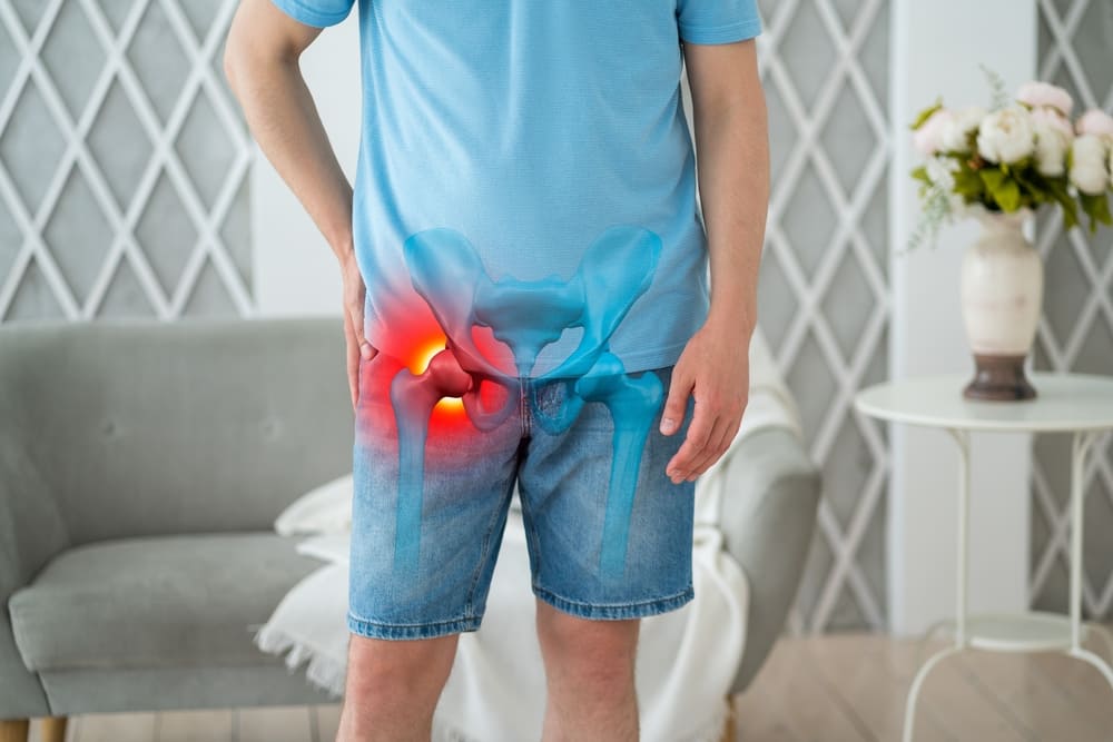 What Is the Risk of Femur Fracture During Hip Replacement?