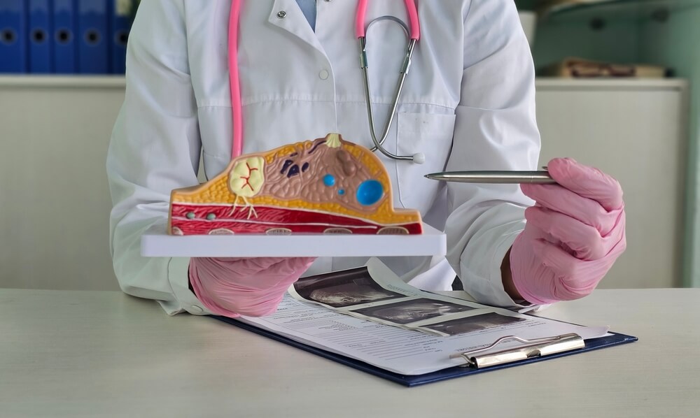How Often Is Breast Cancer Misdiagnosed?